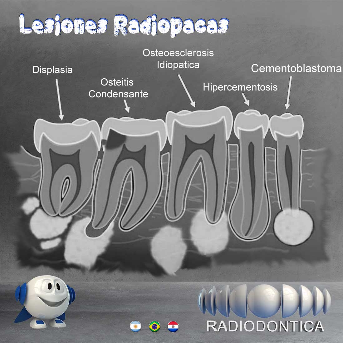 Casos Radiográficos | Radiodontica.ar